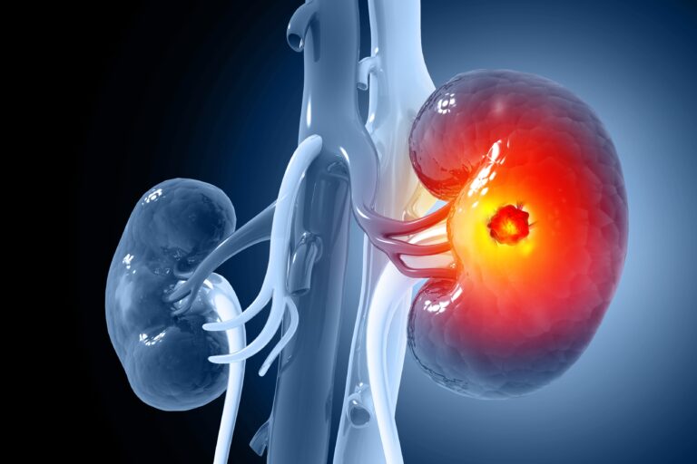Urologist in Noida | Dr. Dushyant Nadar